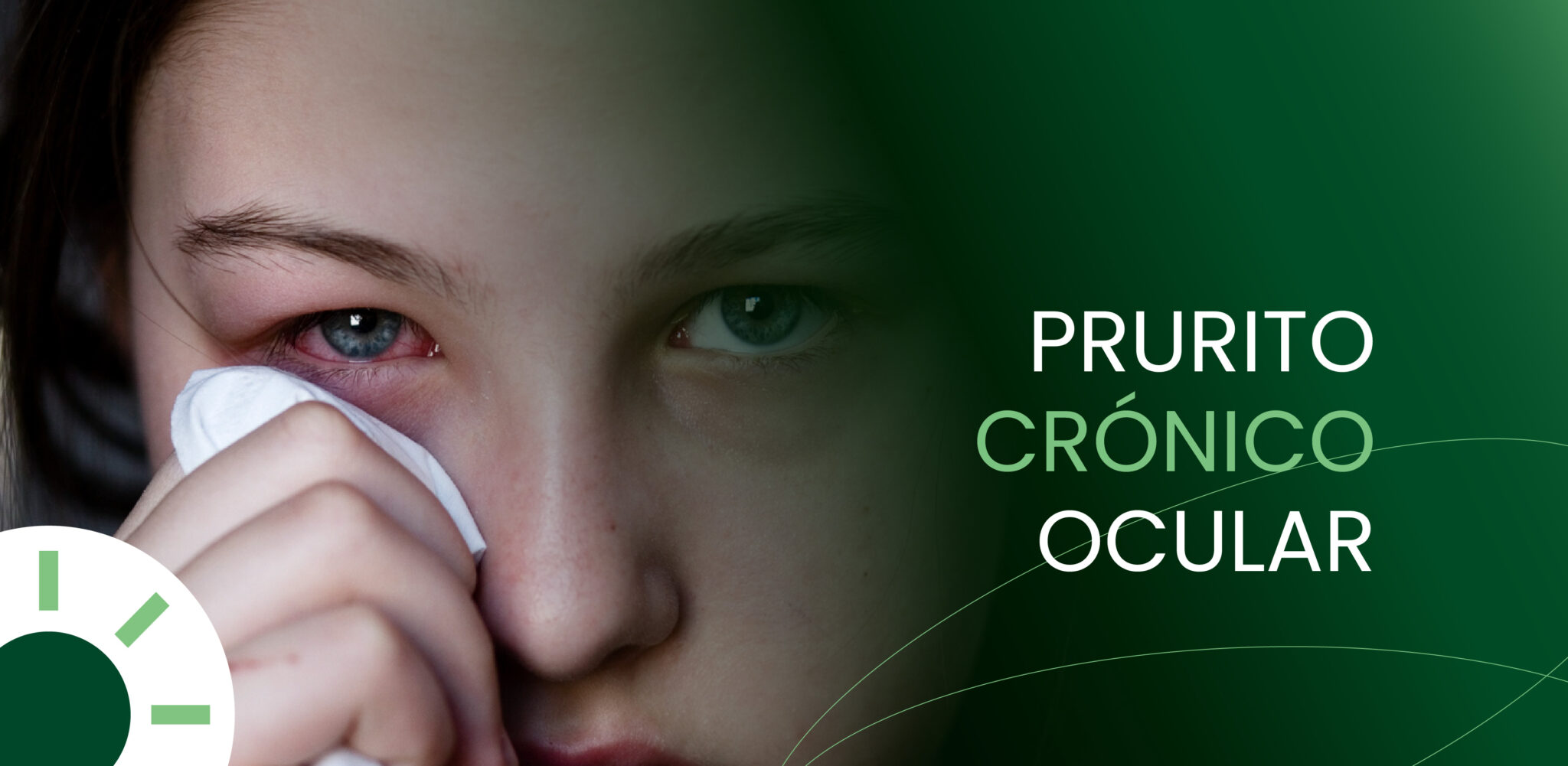 Prurito crónico ocular – Laboratorios Grin